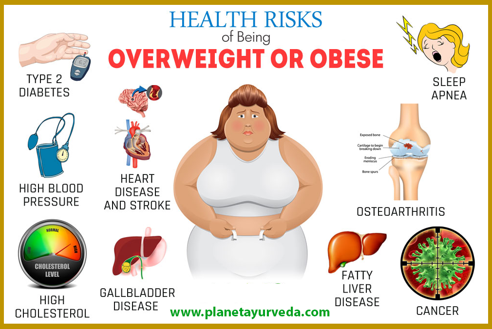Obesity Overweight Risk Factors Weight Loss Herbal Supplements