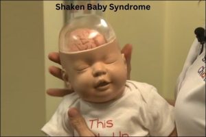 Shaken Baby Syndrome Causes, Symptoms and Treatment